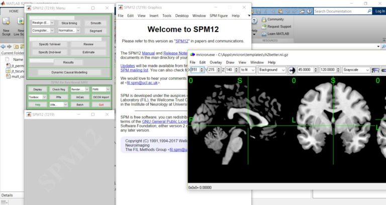 Tools for brain imaging data analysis – myGuide