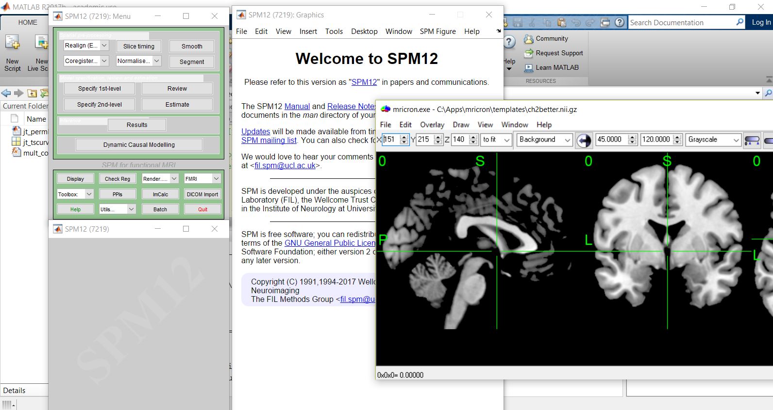 Tools for brain imaging data analysis – myGuide